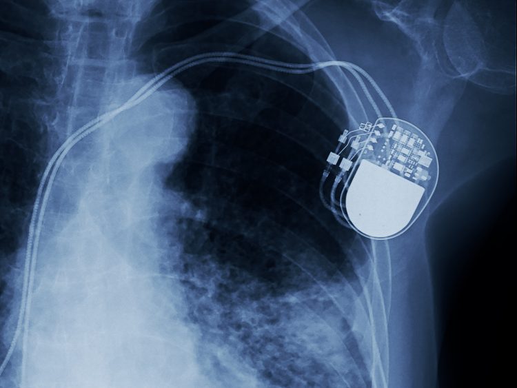 Medical device analysis and testing | ISO 17025 | EAG Labs
